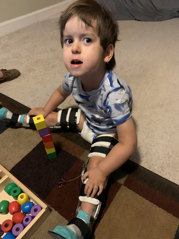 My Son Has Used These Types of Orthotic Braces